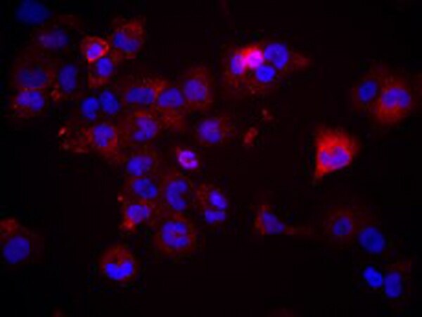 UM-SCC-105 Human Squamous Carcinoma Cell Line | SCC189